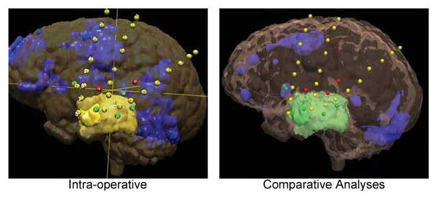 Multi-modality Language Mapping – Golby Lab